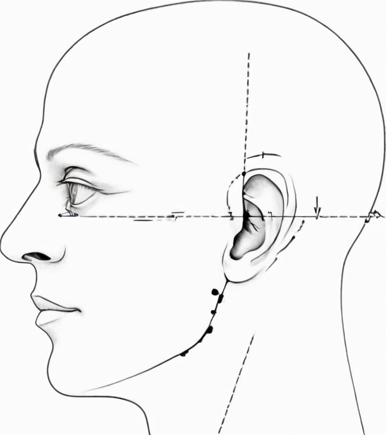 Understanding the Frankfurt Plane - stadiometer.com